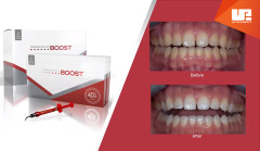 Teeth Whitening Madison WI